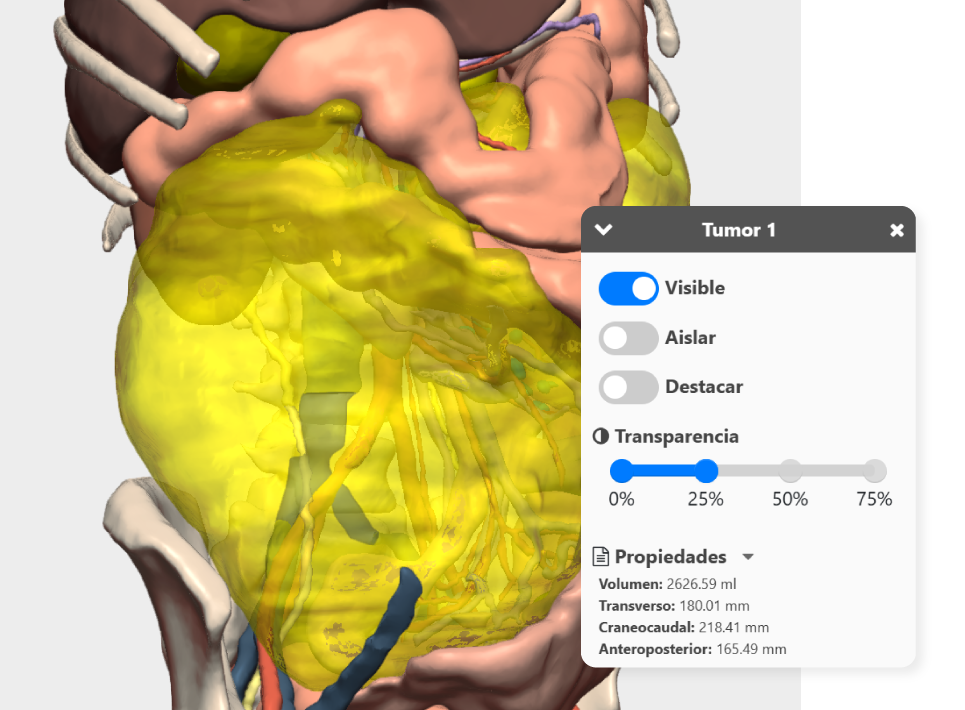 Cirugía peritoneal y retroperitoneal - Cella Medical Solutions
