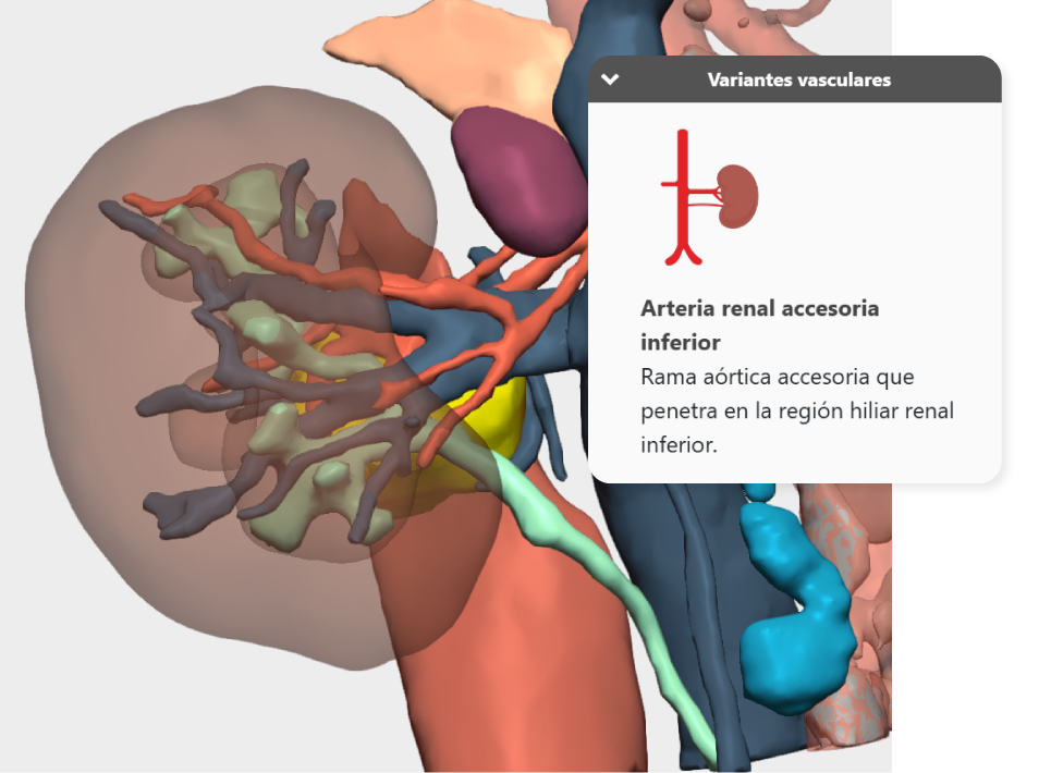 Cirugía renal - Cella Medical Solutions
